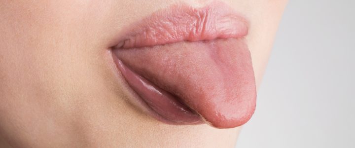 ¿Qué dice mi lengua sobre mi estado de salud? Descubre todos los tipos ...
