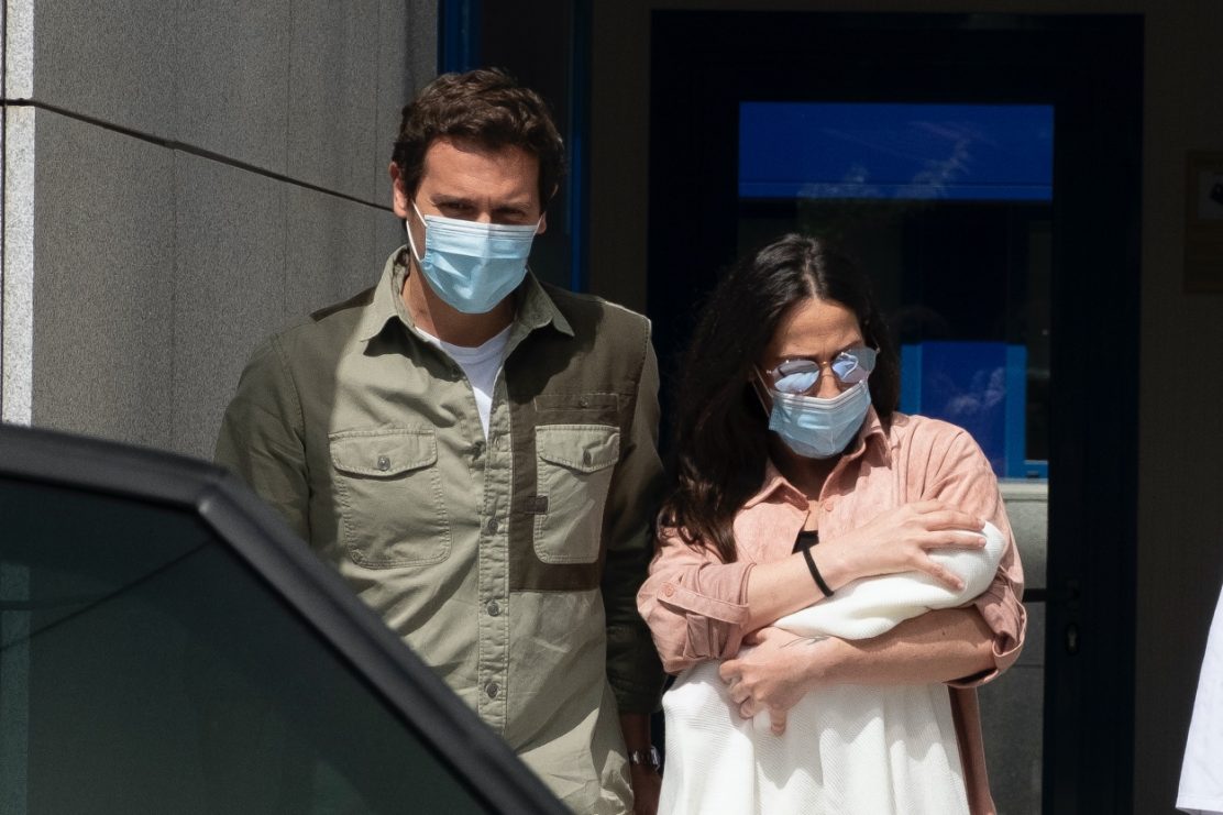 Fotodermatosis: así es la enfermedad que sufre Malú en la piel y de la ...